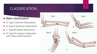 Monteggia fracture dislocation in chldren | PPTX | Death, Injury, or ...