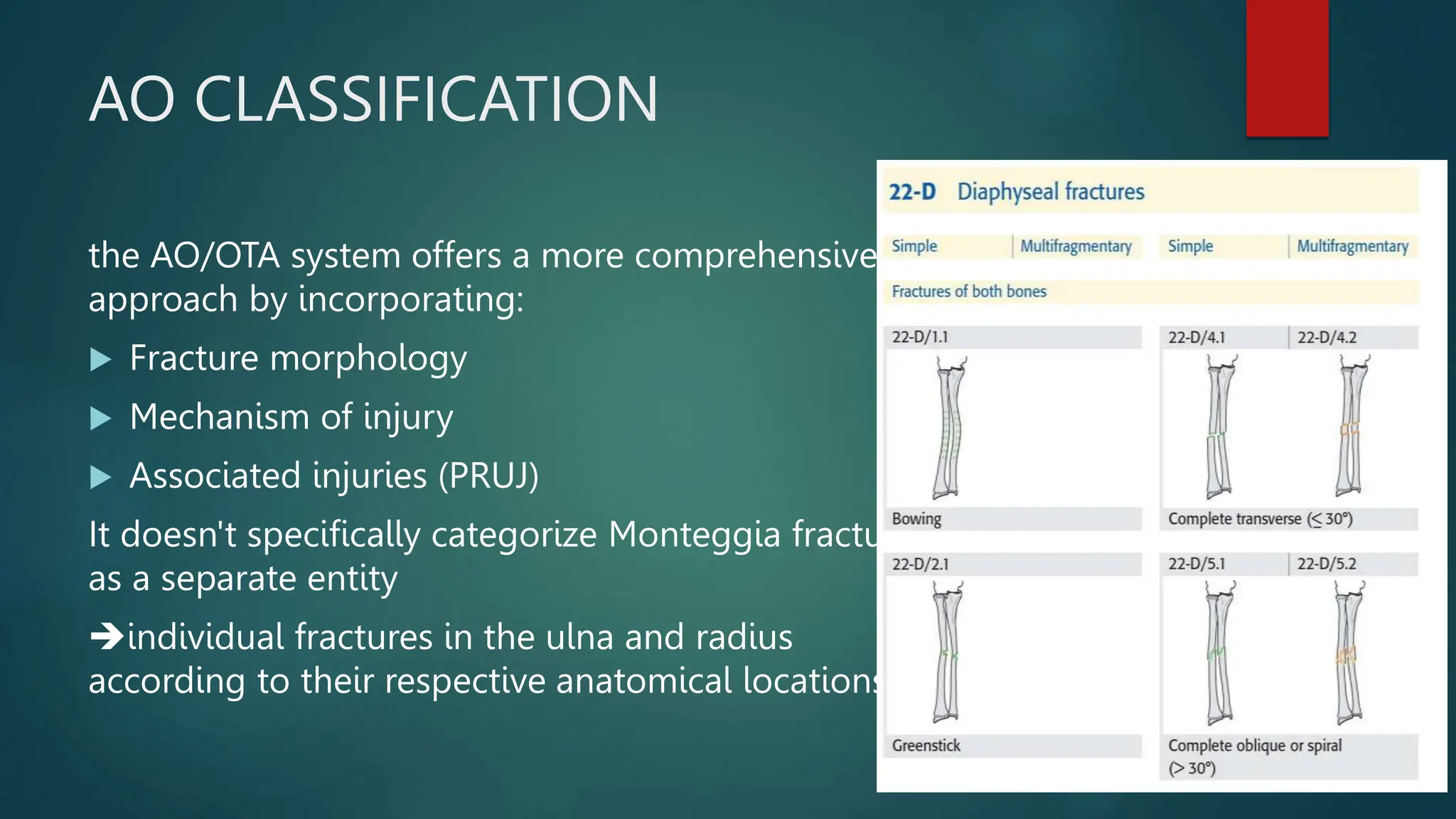 MONTEGGIA FRACTURES CLASSIFICATIONS.pptx