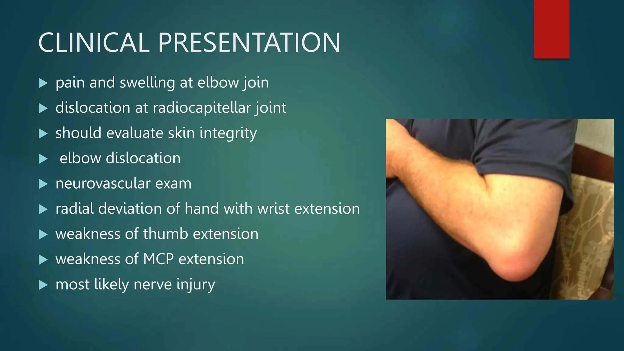 MONTEGGIA FRACTURES CLASSIFICATIONS.pptx