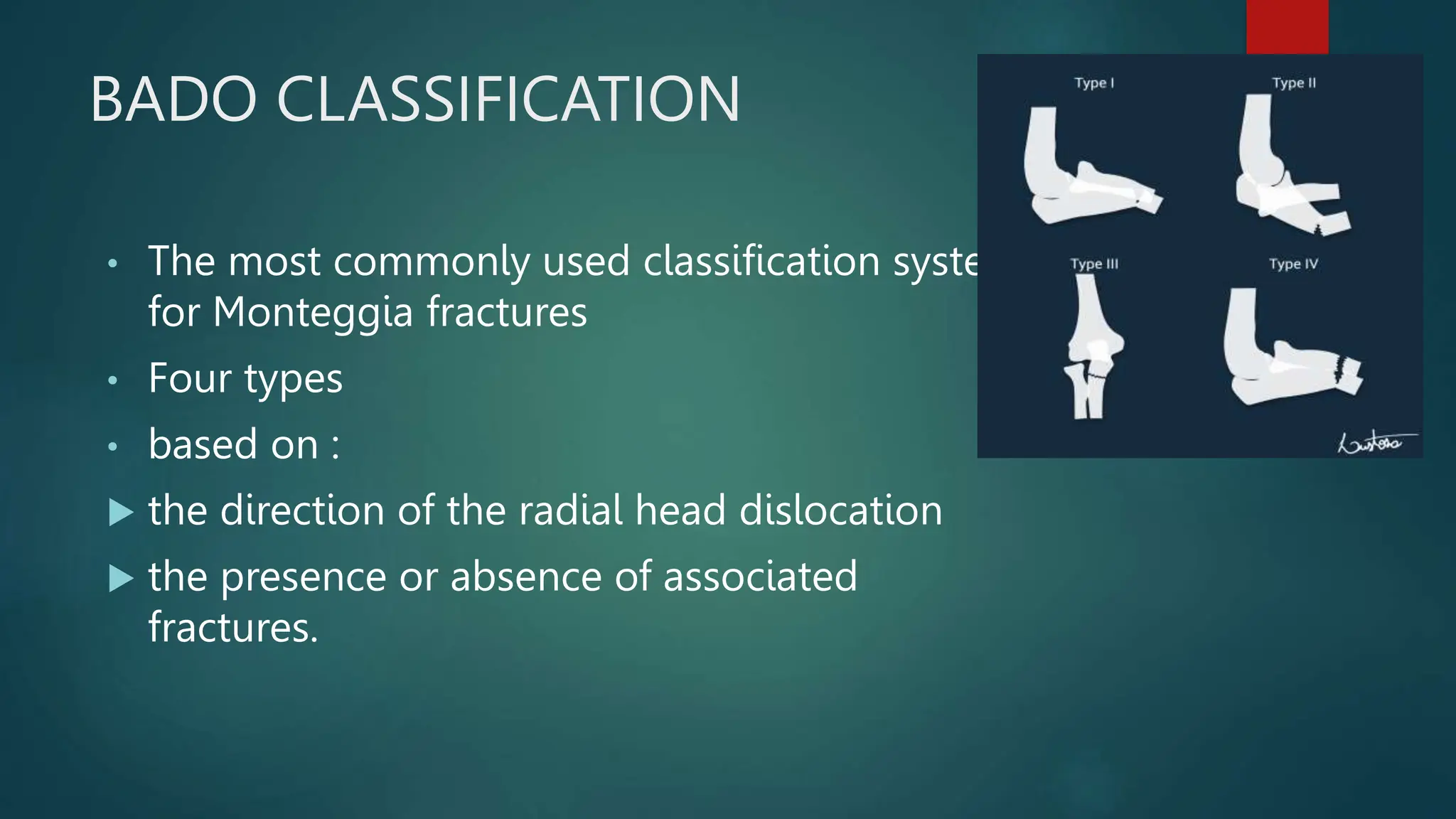 MONTEGGIA FRACTURES CLASSIFICATIONS.pptx