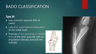 MONTEGGIA FRACTURES CLASSIFICATIONS.pptx
