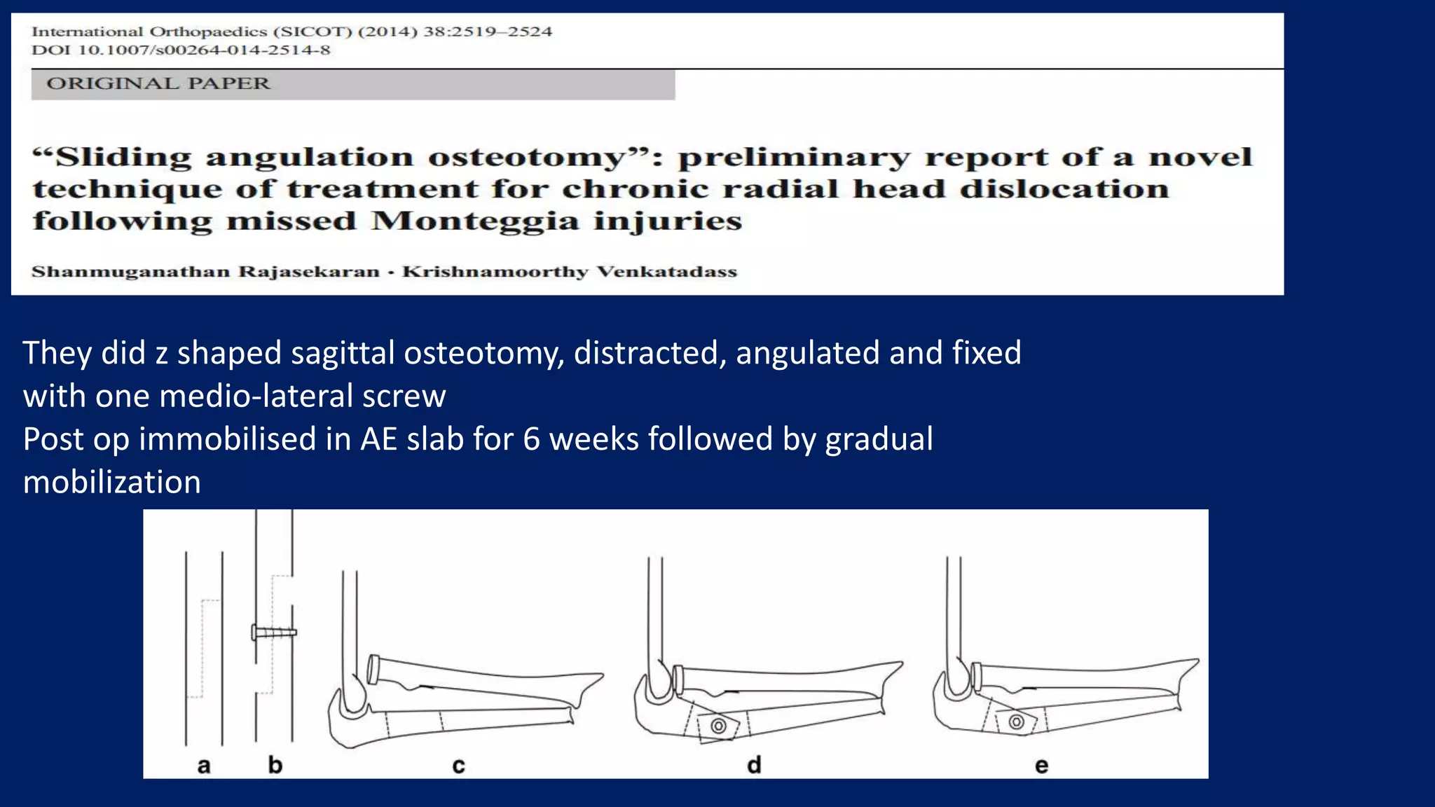 Monteggia fracture dislocation.pptx