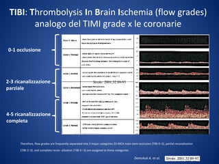 Montinaro E.- Bonaffini N. Il Doppler Transcranico nell'ictus cerebrale ...