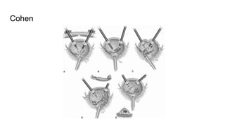 Monti Procedure .pptx