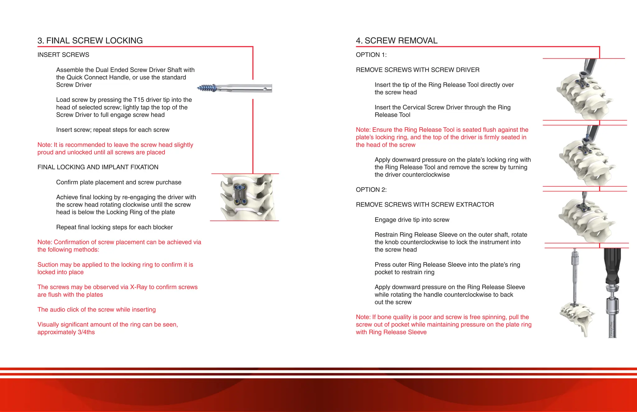 Monza-SGT.Altus-Spine.pdf