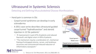 Ultrasound and Systemic Sclerosis | PPT