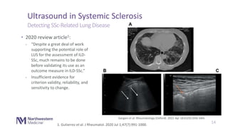 Ultrasound and Systemic Sclerosis | PPTX