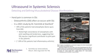 Ultrasound and Systemic Sclerosis | PPTX