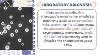 Report about Cryptococcus Neoformans-BSN-1D-C.-Neoformans.pdf