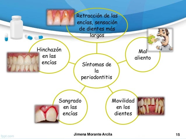 Enfermedades Periodontales