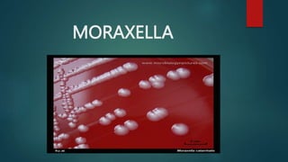 MORAXELLA- Osan.pptx