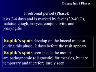 MEASLES | PPT