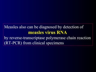 MEASLES | PPT