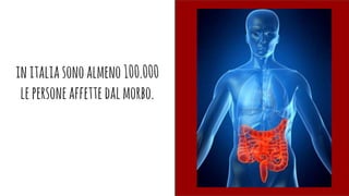 Morbo di crohn, Matilde Migliosi e Alice Signorini | PPTX | Digestive ...