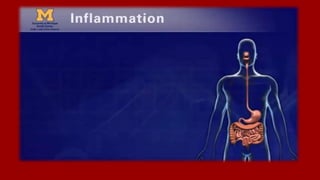 Morbo di crohn, Matilde Migliosi e Alice Signorini | PPTX | Digestive ...