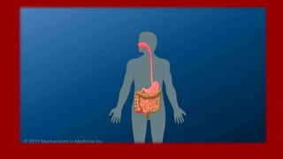 Morbo di crohn, Matilde Migliosi e Alice Signorini | PPTX | Digestive ...