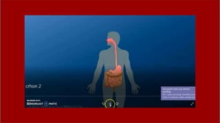 Morbo di crohn, Matilde Migliosi e Alice Signorini | PPTX | Digestive ...