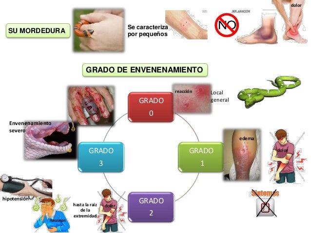 Mordedura de animales