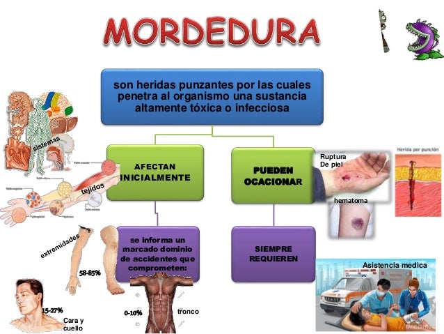 Mordedura de animales