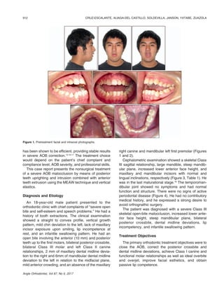 Extreme skeletal open bite correction with vertical elastics Marco ...