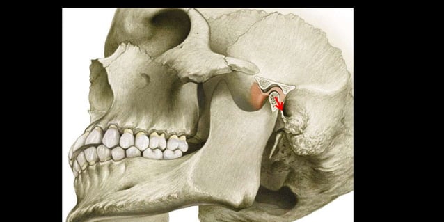 Morfo fisiologia de la ATM Articulacion Temporomandibular | PPT