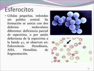 Morfología de Eritrocitos.ppt 2019.ppt