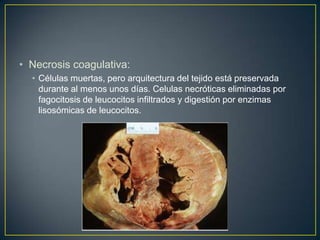 Morfología de la Lesión y Muerte Celular | PPTX