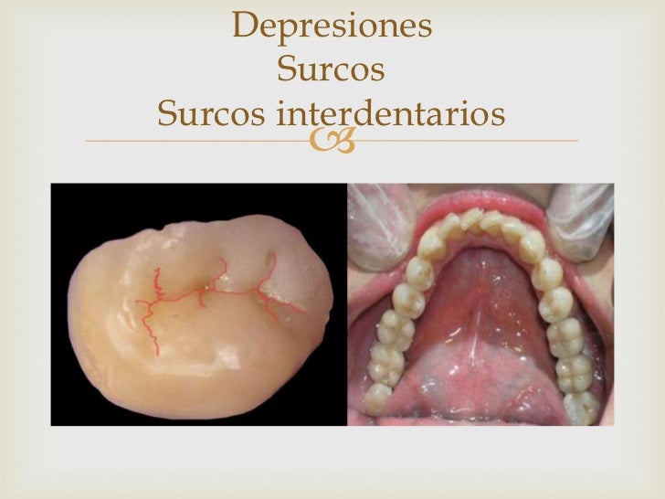 Morfología dentaria