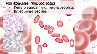 Morfología normal eritroide 2 | PDF