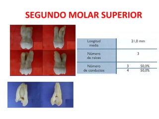 Morfología pulpar | PPT