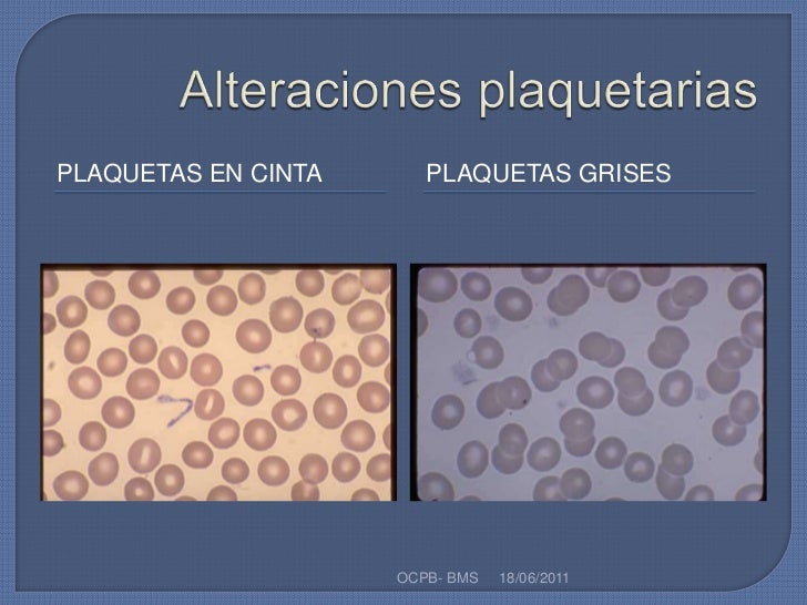 MORFOLOGIA SANGUINEA NORMAL