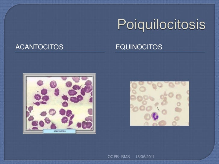 MORFOLOGIA SANGUINEA NORMAL