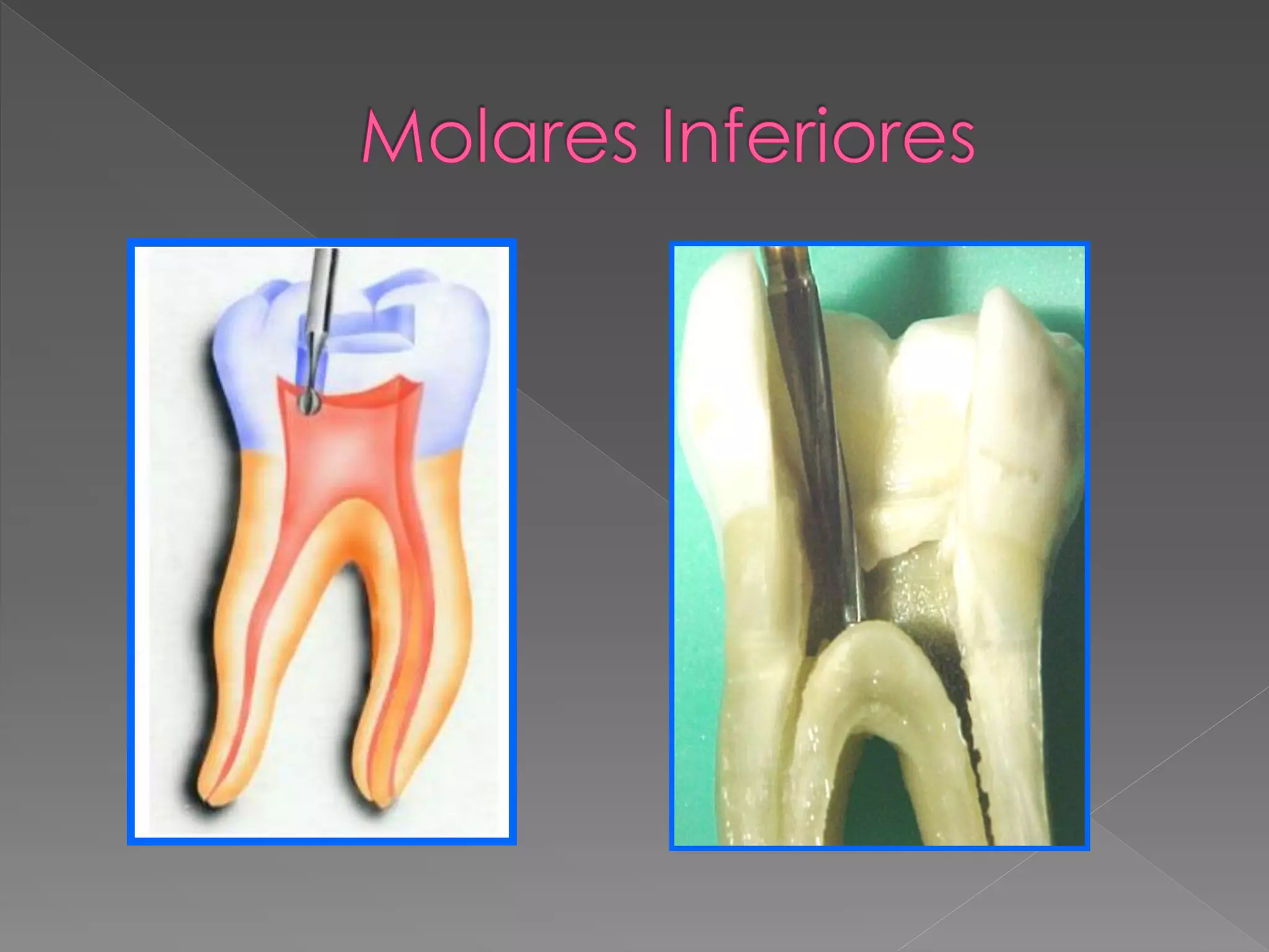 Morfologia de cavidades_pulpares(2) | PDF