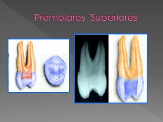 Morfologia de cavidades_pulpares(2) | PDF