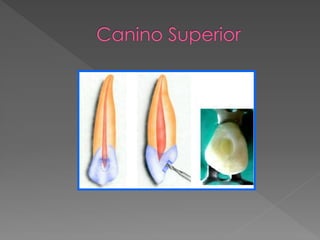 Morfologia de cavidades_pulpares(2) | PDF