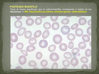 Morfologia Eritrocitaria | PPT