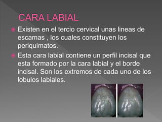 Morfologia Incisivos.pptx
