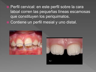 Morfologia Incisivos.pptx
