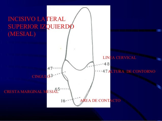 Morfologias de los dientes superiores 2