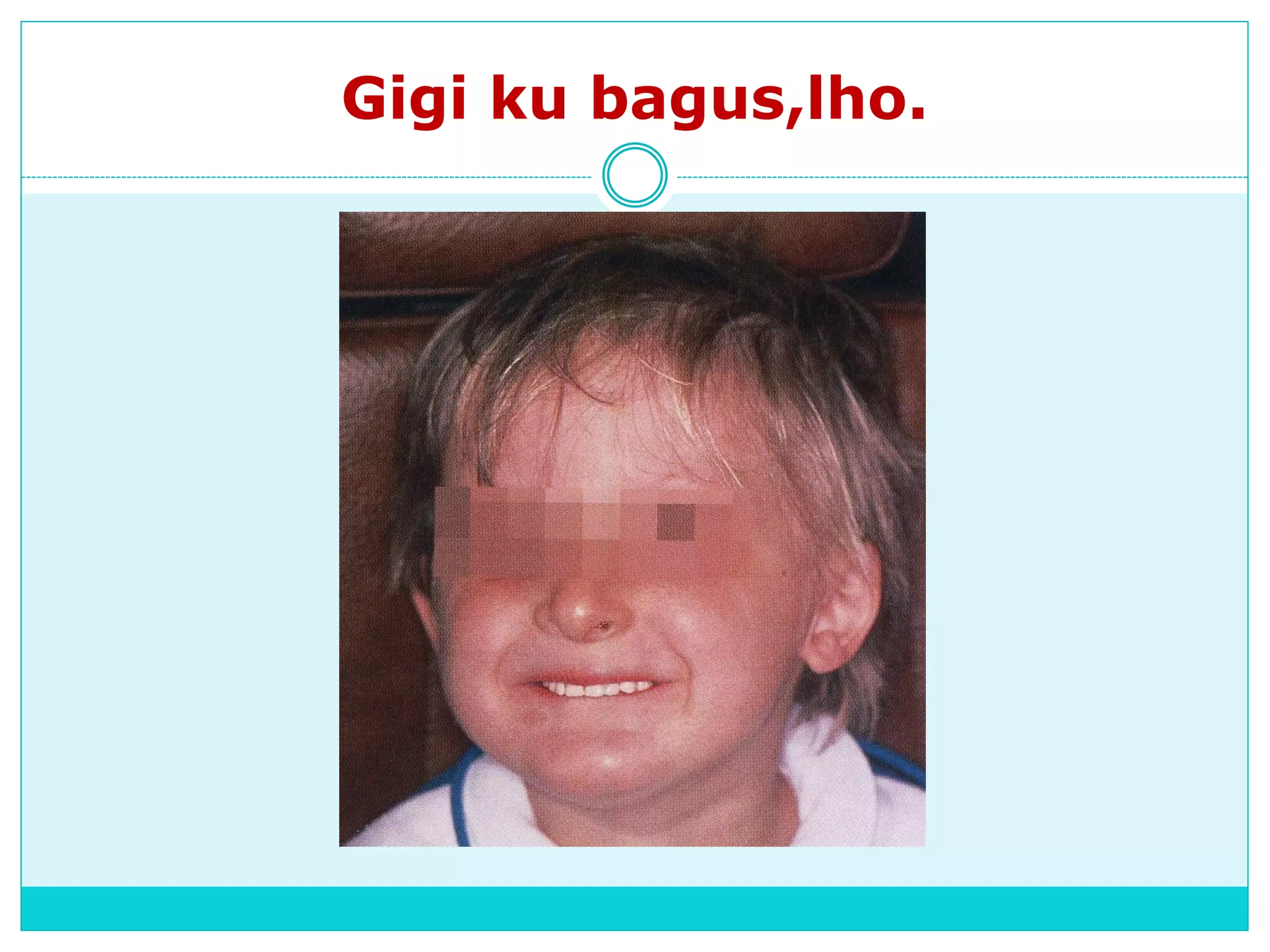 Morfologi Gigi Desidui.pdf