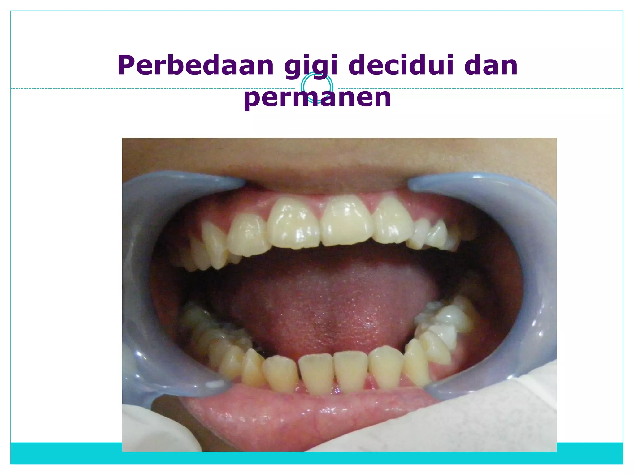 Morfologi Gigi Desidui.pdf