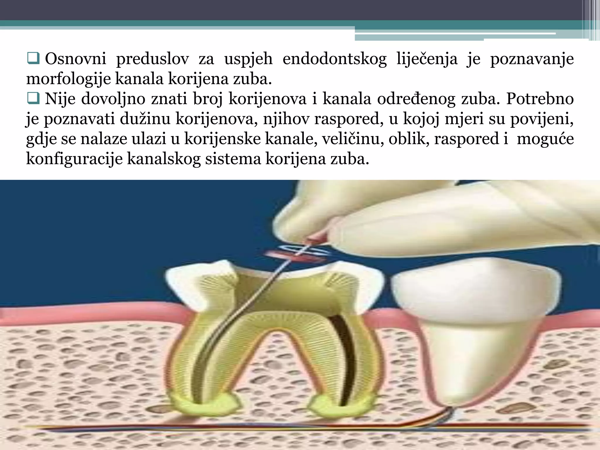 Morfologija kanala korijena zuba | PPT