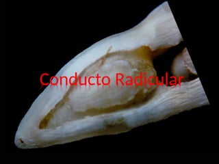Morfologia y anatomía radicular Endodoncia | PPTX