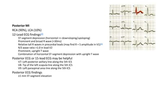 STEMI Equivalent | PPTX