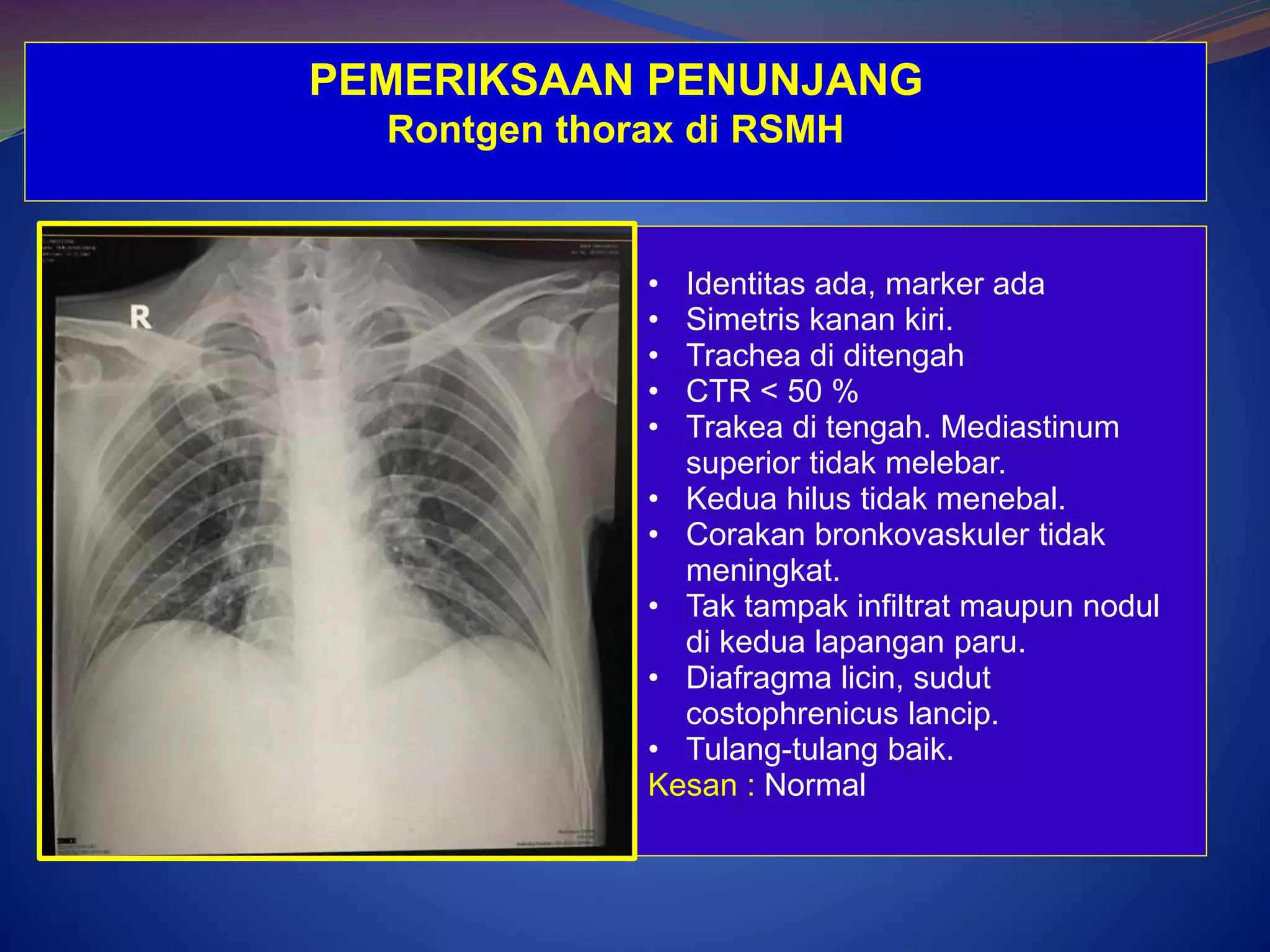 morning report EKG 1.pptx