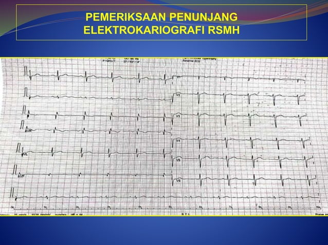 morning report EKG 1.pptx