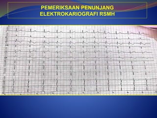 morning report EKG 1.pptx