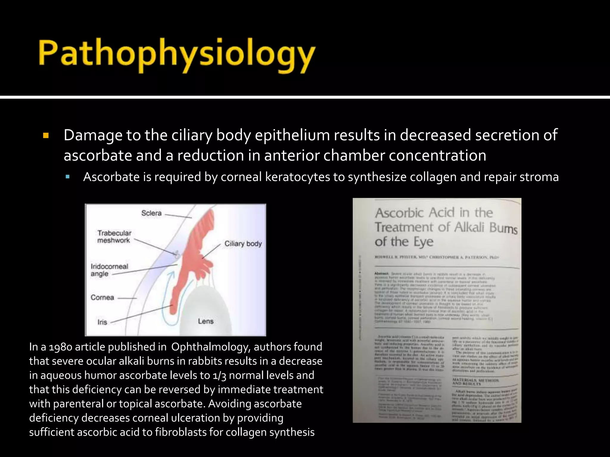 Ocular Chemical Burns - Pathophysiology and Evidence-Based Treatment | PPTX