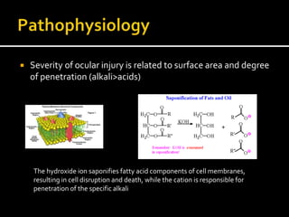 Ocular Chemical Burns - Pathophysiology and Evidence-Based Treatment | PPTX
