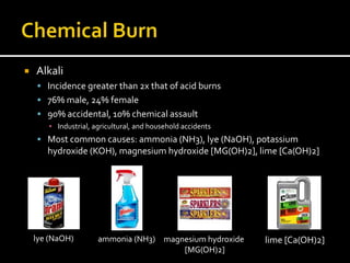 Ocular Chemical Burns - Pathophysiology and Evidence-Based Treatment | PPTX